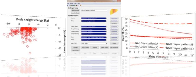 NAFLDsym® - Simulations Plus