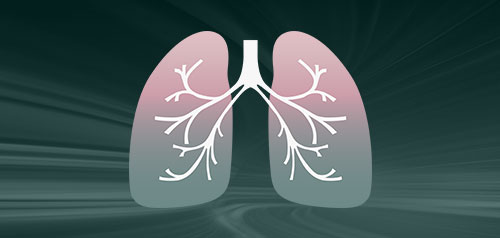 IPFsym® - Simulations Plus