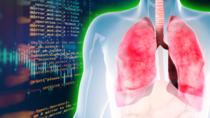 GastroPlus® PBPK & PBBM Modeling and Simulation